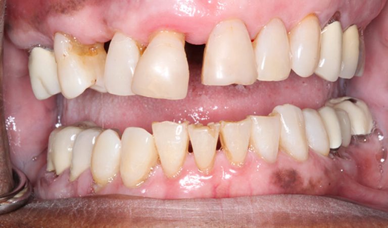 Dr. Stas Tkatch DDS | Leading Dentist in High Point NC